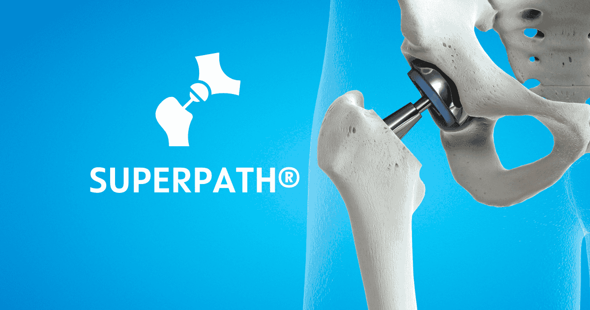 Операция на тазобедренном суставе по технологии SuperPath - статья ...